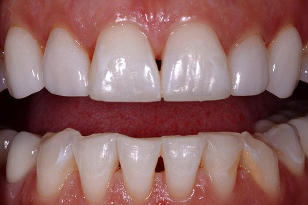 Dentist Charlotte, NC - Dentistry - Porter Dental Group