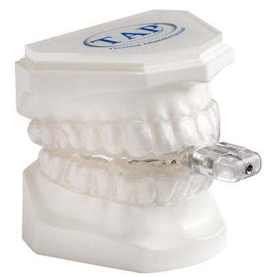TAP® Thornton Adjustable Positioner - Birmingham, AL - Sleep Apnea
