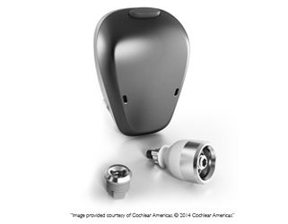 Hearing Loss Treatment - Ear Reconstruction