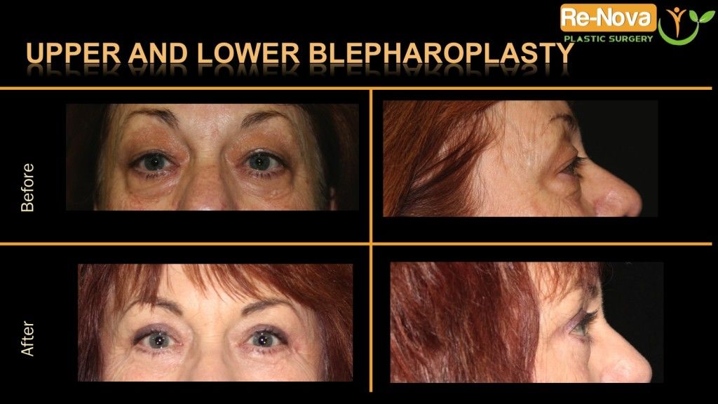 Top Plastic Surgeon Pittsburgh, PA - Best Reviewed Cosmetic Surgery