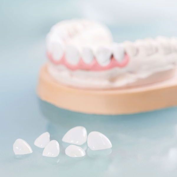 Dentist Nashville, TN - Dentistry - Gulch Dental Studio
