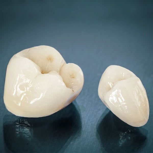 Dentist Nashville, TN - Dentistry - Gulch Dental Studio