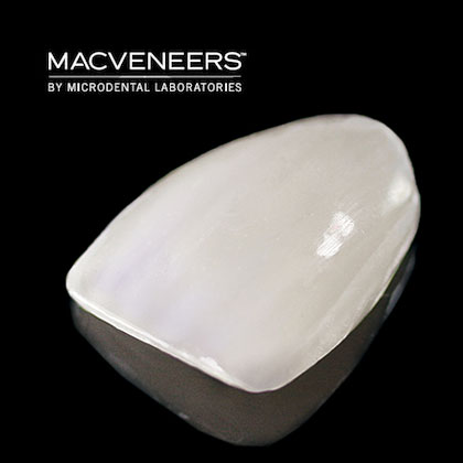 Veneers Nashville, TN - Porcelain Veneers - Clint Newman, DDS