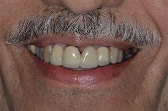 Dentist - Amarillo, TX - Pampa, TX - Dumas, TX - Shemen Dental Group