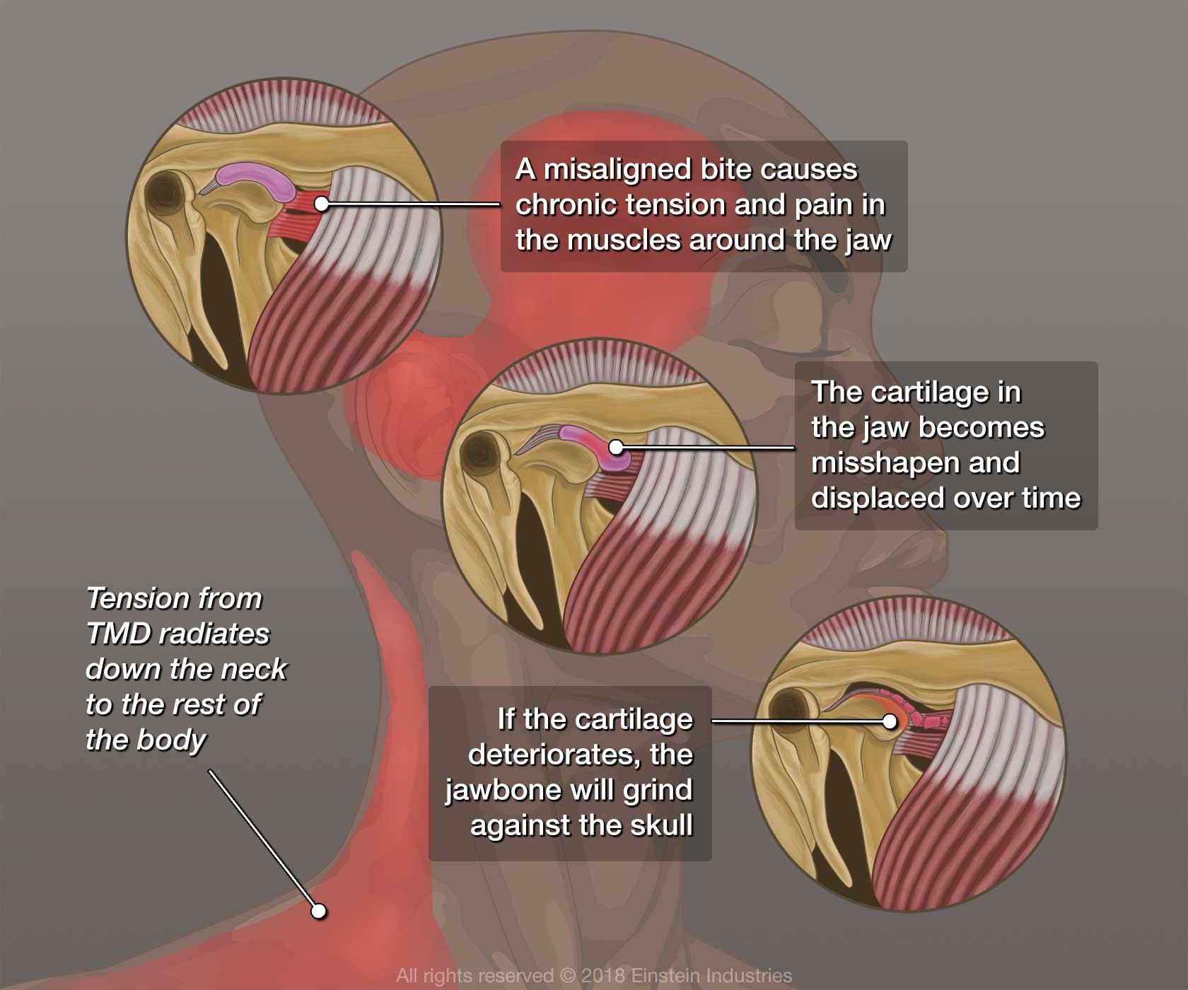 TMJ Missouri City TX Richmond TX Fort Bend County TMJ Treatment TMJ Missouri City TX Richmond TX Fort Bend County TMJ Treatment
